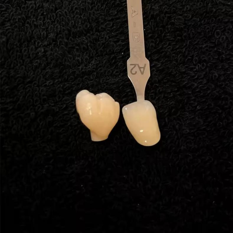 Strength and Aesthetics: Zirconia Blocks in Focus - XANGTECH
