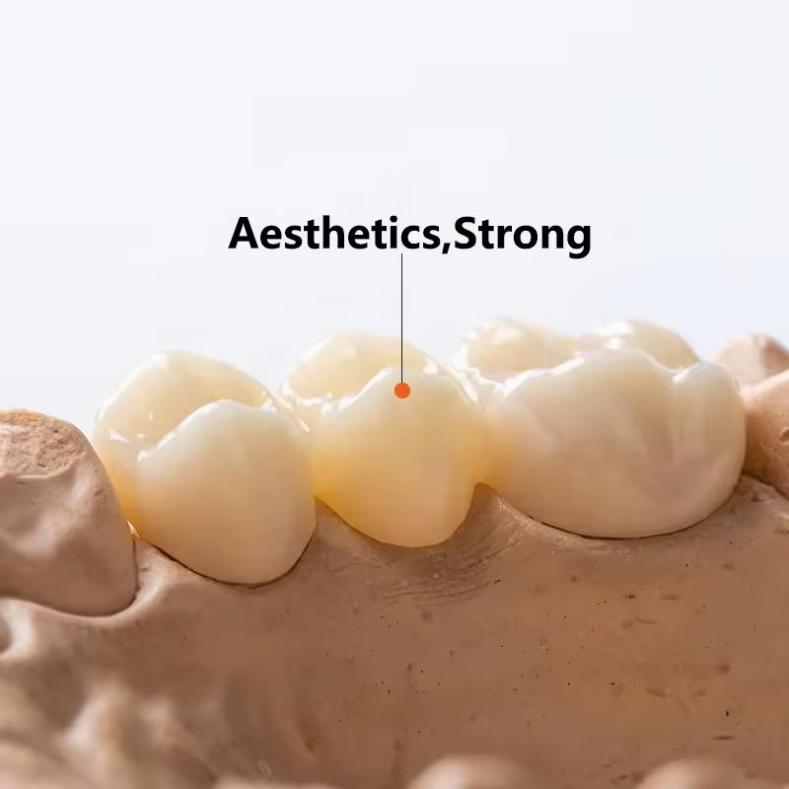 Understanding Dental Zirconia Block Types and Their Applications - XANGTECH