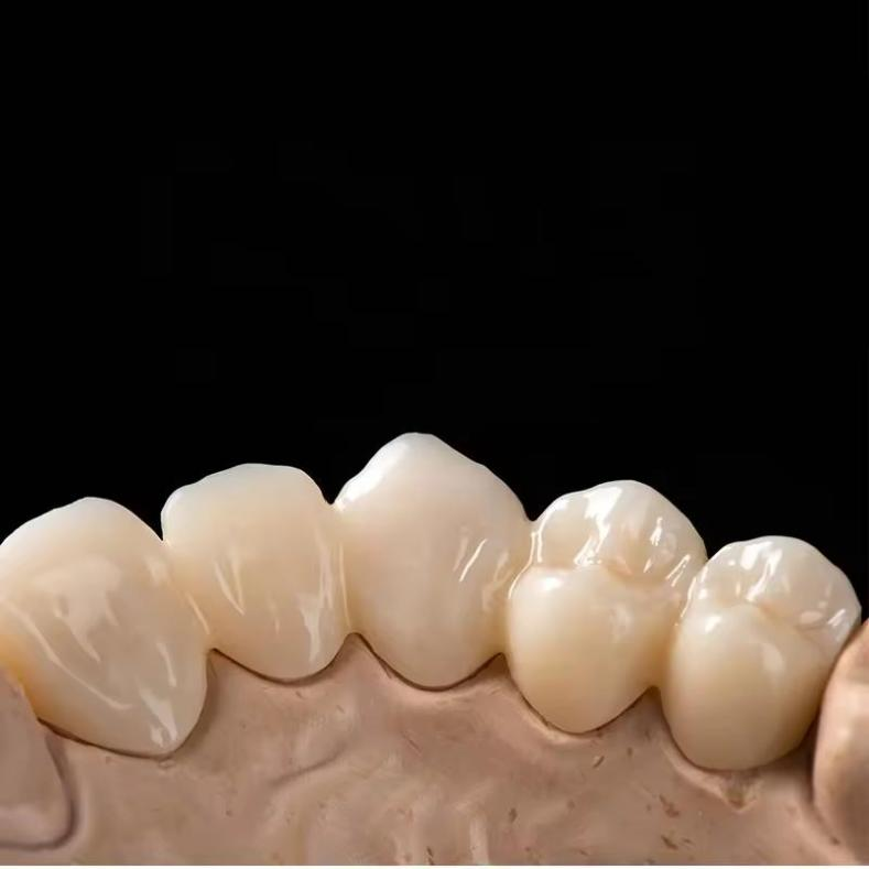 Boost Efficiency with Dental Zirconia Block: Why High Translucency ...